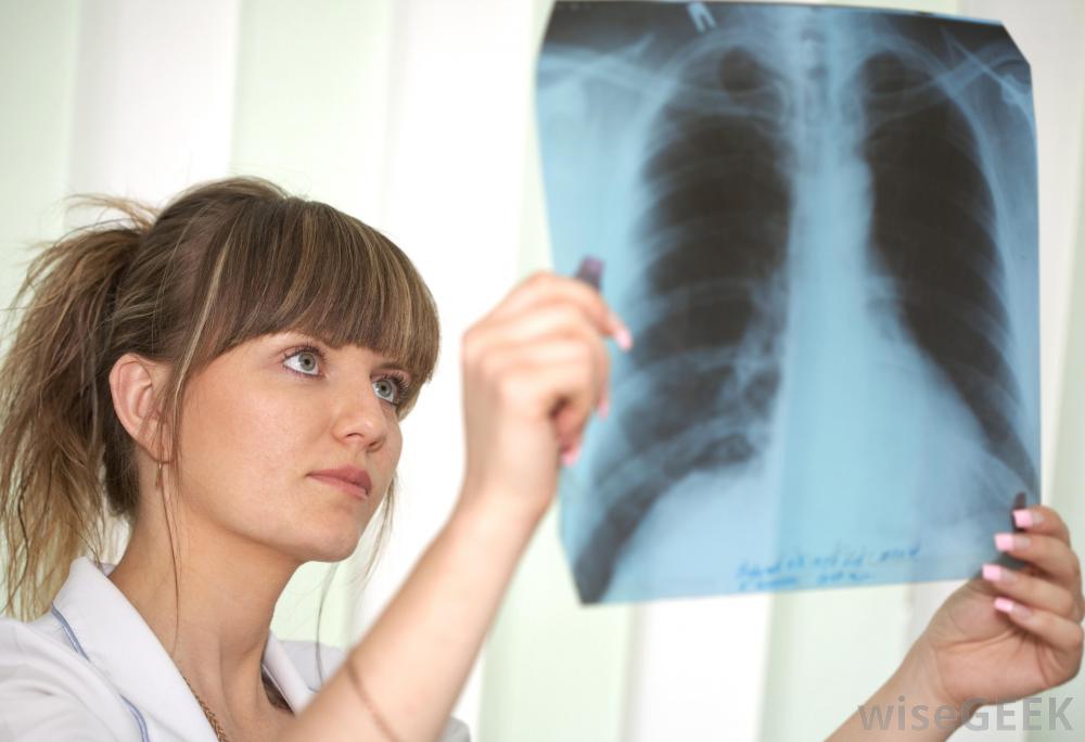Pneumonia Causes, Symptoms & Treatments | New Health Advisor
