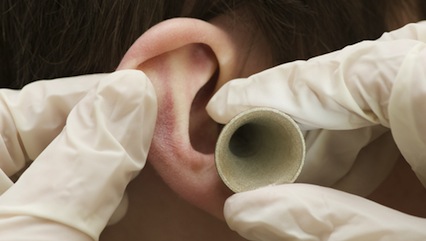 How to Remove Excessive Ear Wax | New Health Advisor