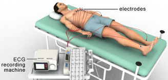 What's an Electrocardiogram (EKG) Test? | New Health Advisor