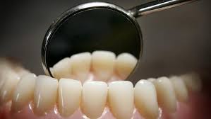 Can Tooth Enamel Heal and Grow Back? | New Health Advisor