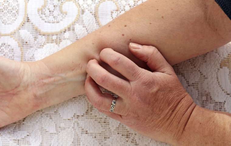 What Causes Itch Uncontrollably and How to Remedy It? | New Health Advisor