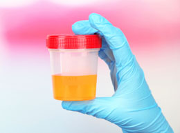Urine Output: What's Normal and What's Not? | New Health Advisor