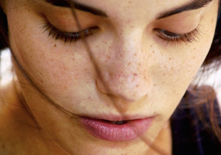 Dark Spots on Your Face: Causes and Remedies | New Health Advisor
